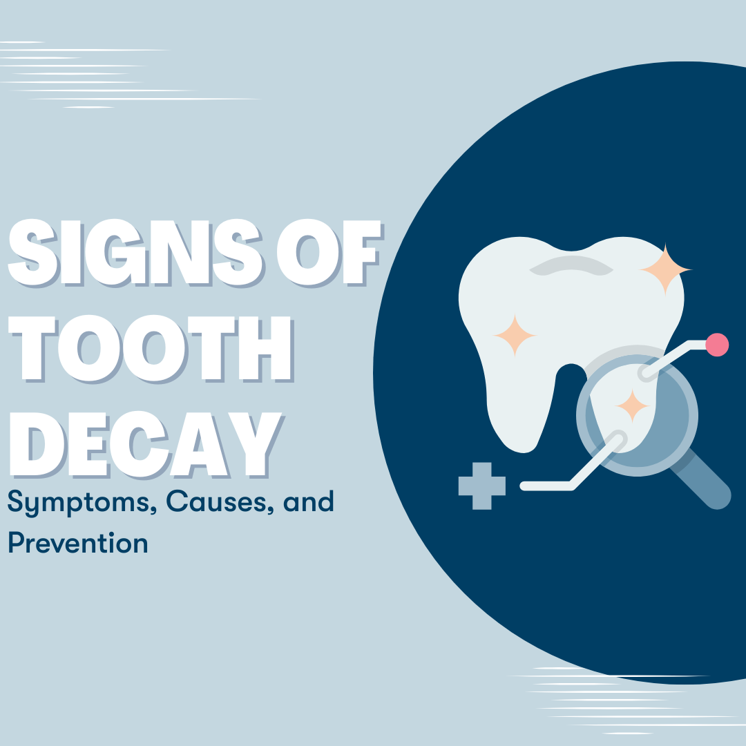 Signs of Tooth Decay: Symptoms, Causes, and Prevention - Sapulpa Family ...